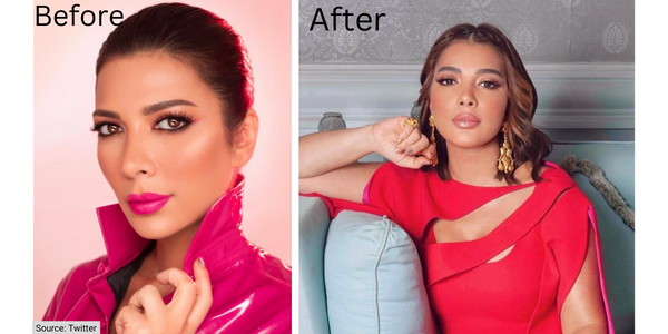 Sham Al Zahabi Defends Asala Amid Dramatic Facial Change | Al Bawaba